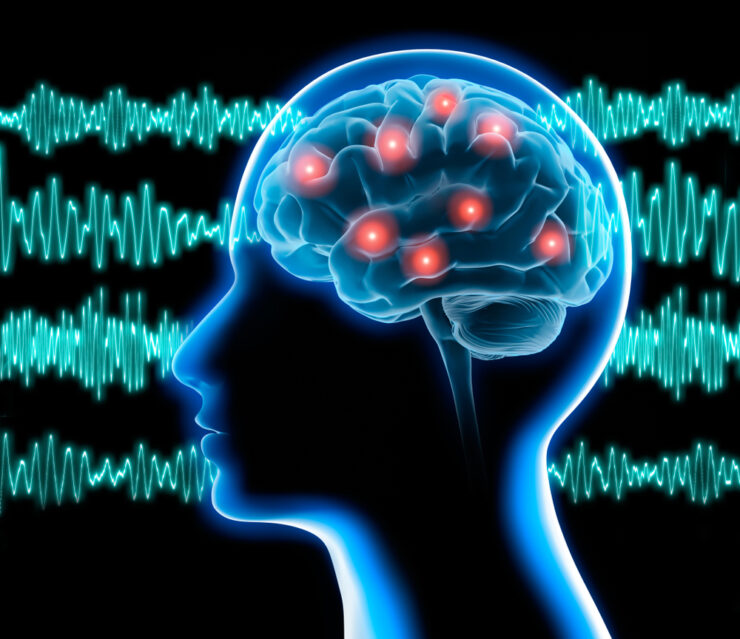 AI decodes speech from non-invasive brain recordings | DailyAI